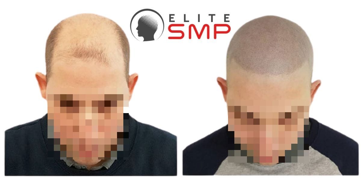 Scar Camouflage - Everything You Need to Know - Elite SMP